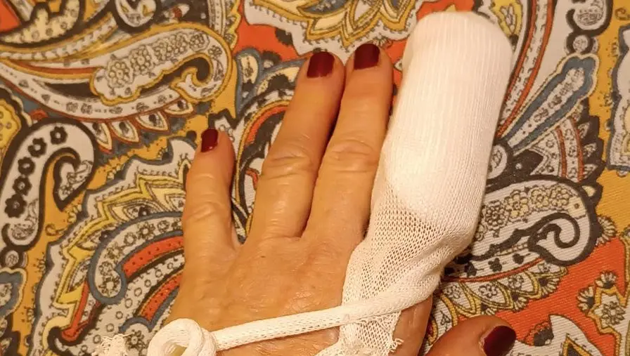 Aggredita da due cani in strada a Brescia: «Dito rotto e tanta paura ...